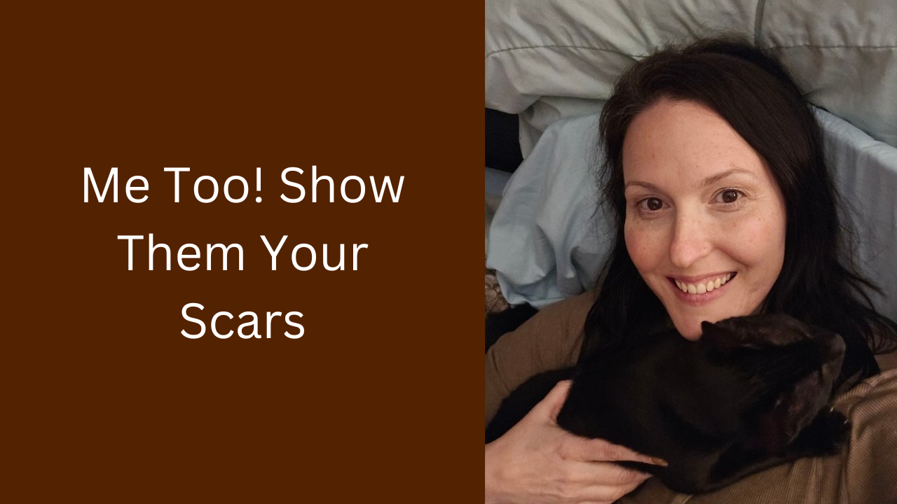 Me Too! Show Them Your Scars. Turning Pain into Purpose. | Emily-Rose ...
